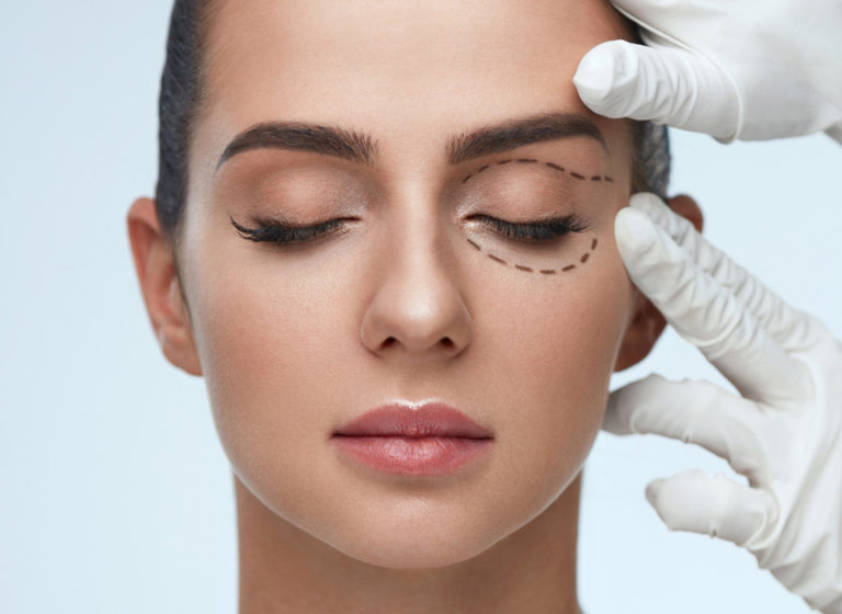 Revision Eyelid Surgery | Secondary Eyelid Revision